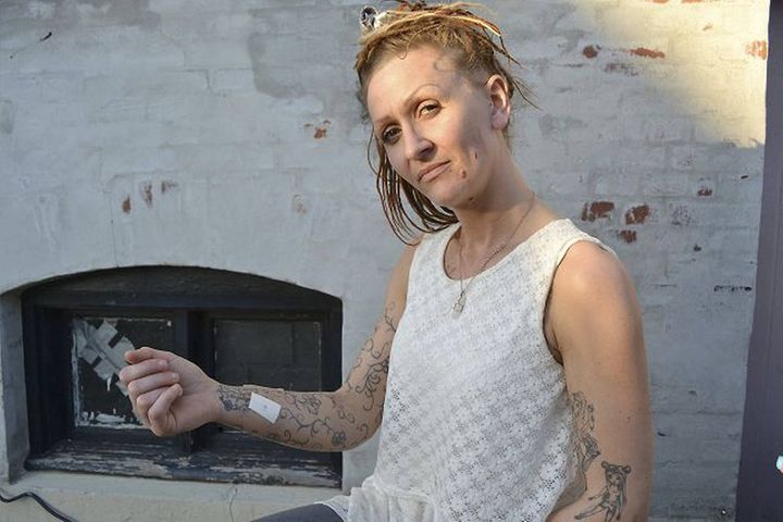 29-årige Chanette bidt i hals, ansigt og arm - sådan ser hun ud dagen ...